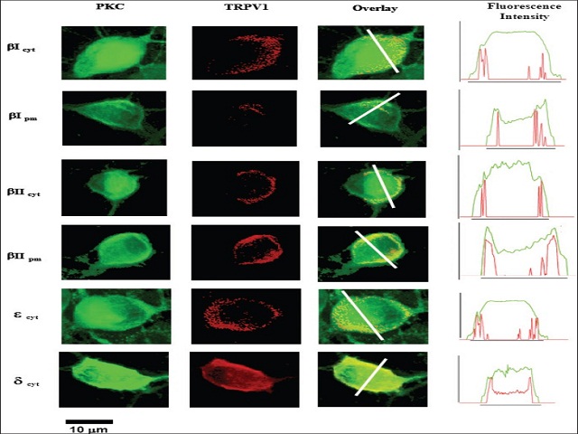 Protein kinase C modulation of thermo-sensitive transient receptor ...